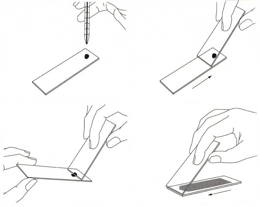 Preparation And Staining Of Peripheral Blood Smear(PS)|A Step-by-Step ...